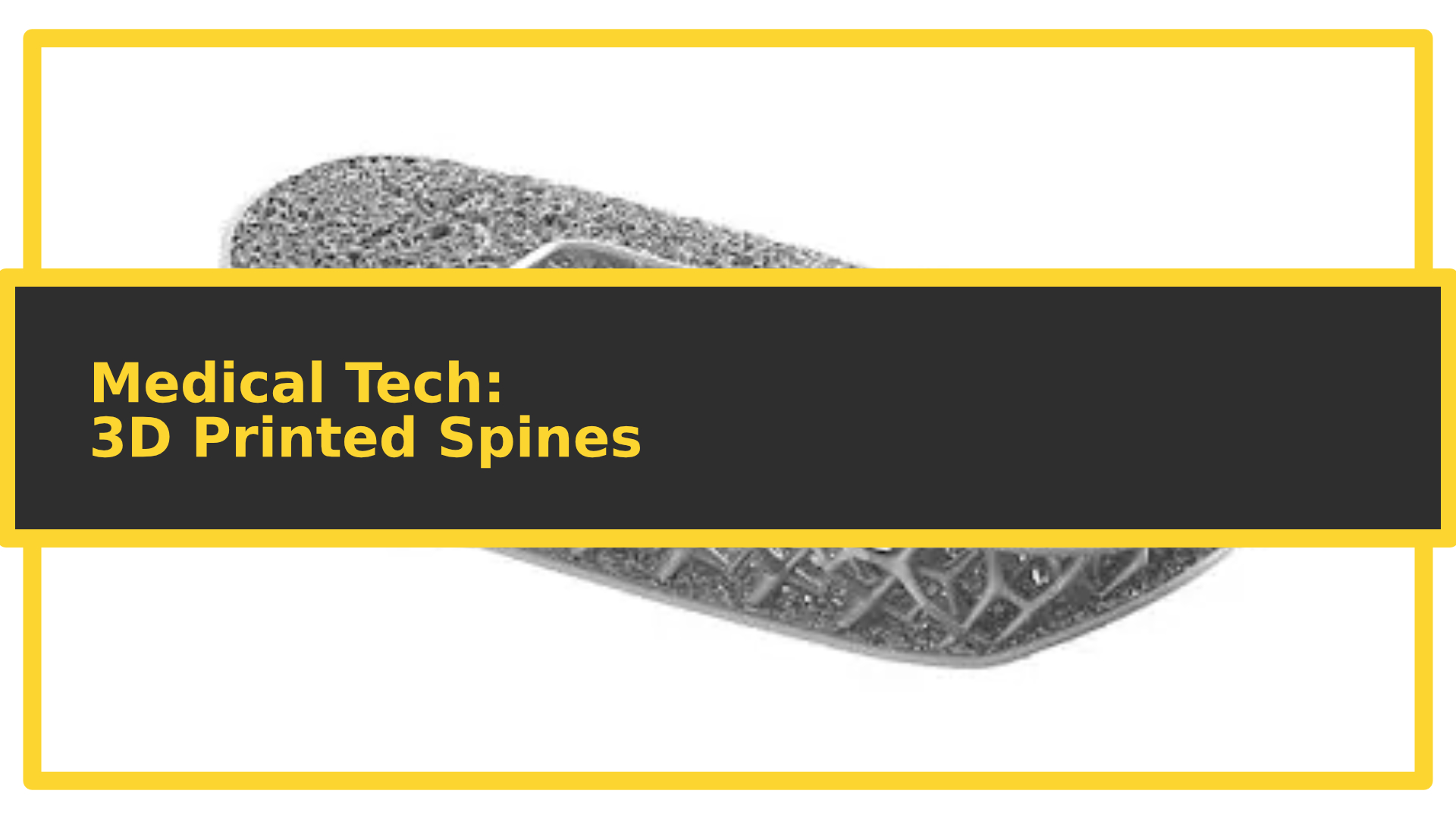 Unlocking the Possibilities of 3D Printed Spines in Medicine